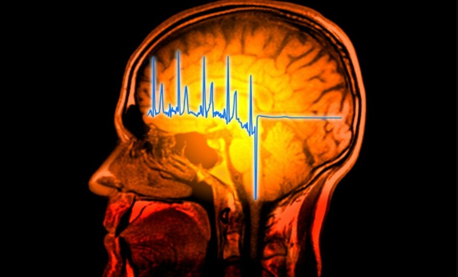 Brain Drain- Article (4) | Katy Christian Magazine